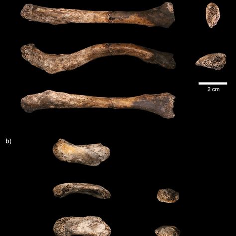 Pdf Upper Limb Fossils Of Homo Naledi From The Lesedi Chamber Rising