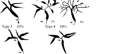 Cholangiographic Classification Of Igg4 Sc Referred From Reference 18 Download Scientific Diagram