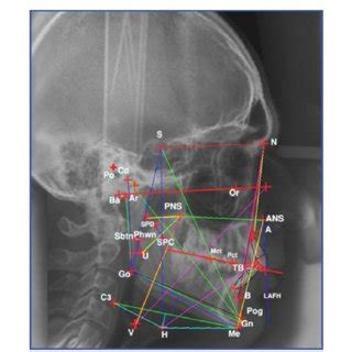 Angular And Linear Measurements Used In This Study Download Scientific Diagram