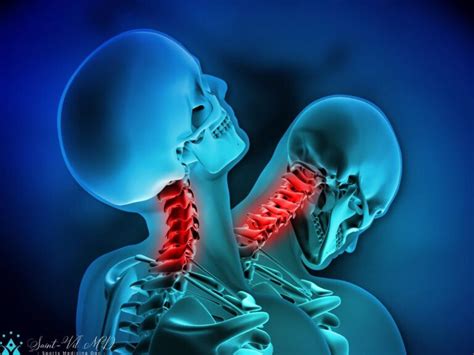 Modified Thomas Stretch Exercisenow