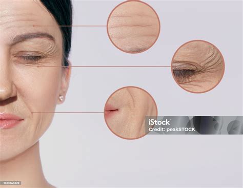 주름 이마의 노화 비강 주름 및 눈 주위 노화와 관련된 피부 변화 주름에 대한 스톡 사진 및 기타 이미지 주름 피부 노화