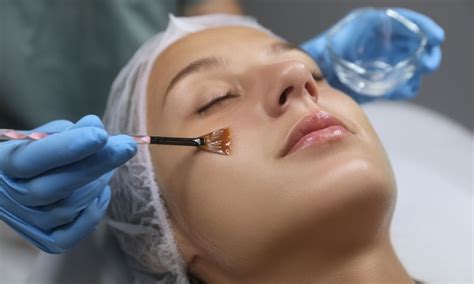 Peeling Facial En Panamá Renueva Tu Piel