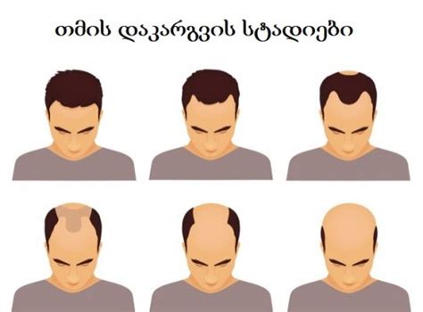 8 უცნაური ფაქტი მამაკაცის სხეულის შესახებ