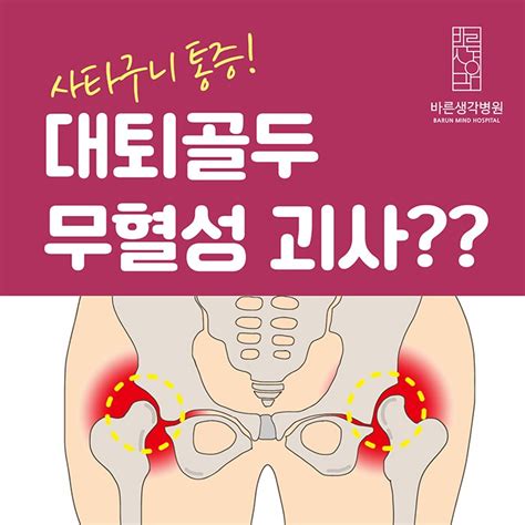 대전관절병원 고관절이 보내는 신호 지속되는 허리 사타구니통증 대퇴골두무혈성괴사 네이버 블로그