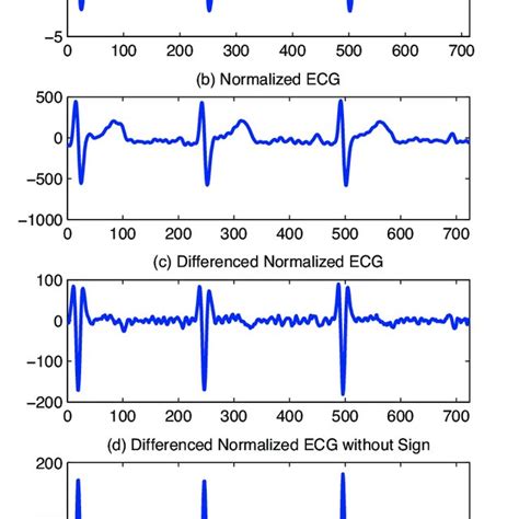 Preprocessing Stages Of Ecg Compression Download Scientific Diagram
