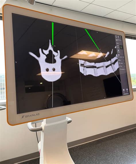 Brainlab On Linkedin Spine Surgery Digitalhealth Halloween Medtech