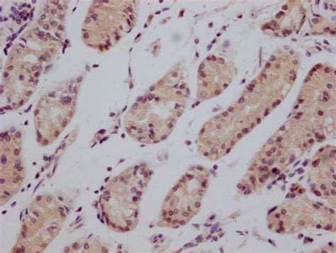 Anti Homo Sapiens Human Cd147 Recombinant Monoclonal Antibody Cusabio