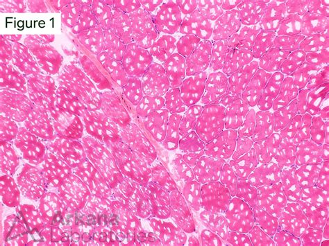 Freezing Artifact Neuro Notes Arkana Laboratories