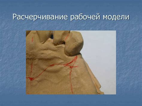 Нанесение границ каркаса бюгельного протеза презентация онлайн