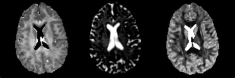Qmenta Imaging Biomarker Analysis Catalog