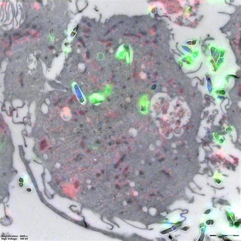 The Fat Is In The Lysosome How Mycobacterium Tuberculosis Tricks