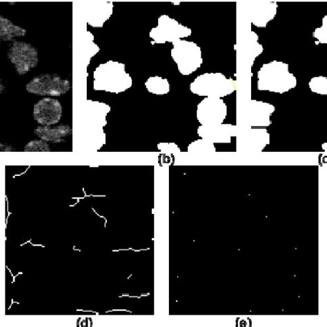segmentation and localization of nuclei a the original image of
