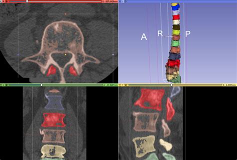 NA MIC Project Weeks Website For NA MIC Project Weeks