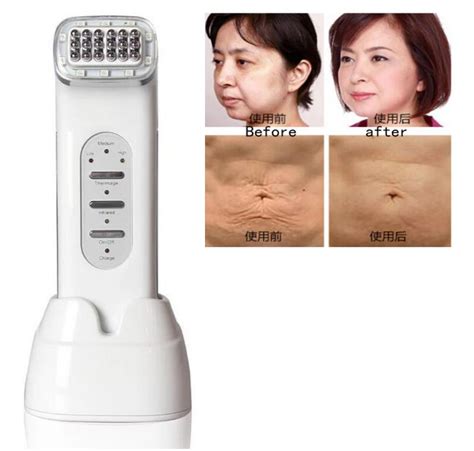 Rf Wrinkle Removal Beauty Machine Dot Matrix Facial Thermage Radio