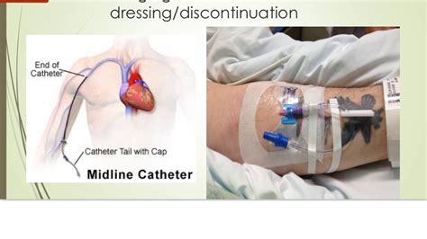 Iv Therapy Module 6 Tri Rivers Youtube