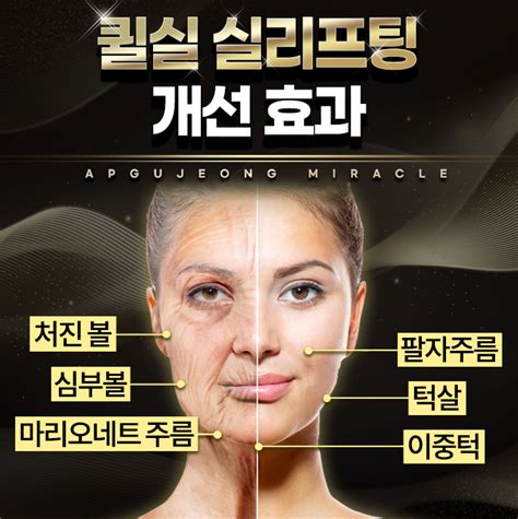 실리프팅 실 종류 정하는 기준