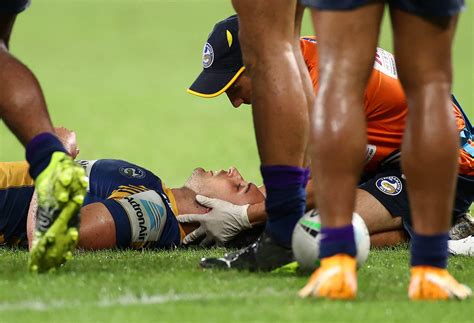 How The Nrl Fixed The Concussion Problem