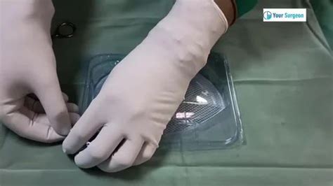 Hernia Kit Ethicon Size 4 X 6 Cm Biologic Mesh At Rs 1100piece In