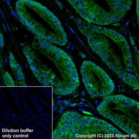 Alexa Fluor® 488 Alexa Fluor® 488 Anti Braf Antibody [ep152y] Ab309244
