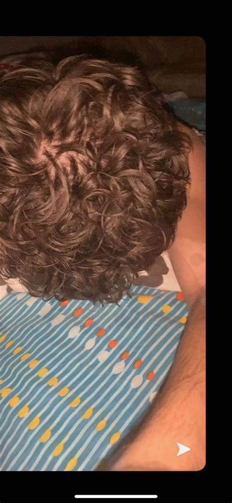 Is This Normal For My Scalp To Look Like This Or Is This A Sign Of Male Pattern Baldness Or