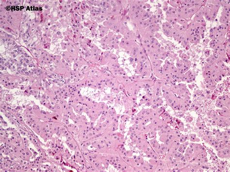 Hsp Atlas Histopathology Atlas Urinary