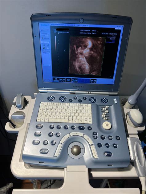 Sistema de Ultrassom Voluson I Geral e 4D Portal do Médico
