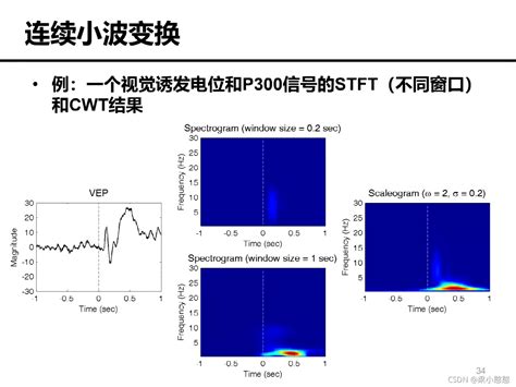 脑电的频谱分析和时频分析 Eeg Processing And Feature 5 脑电时频图 Csdn博客
