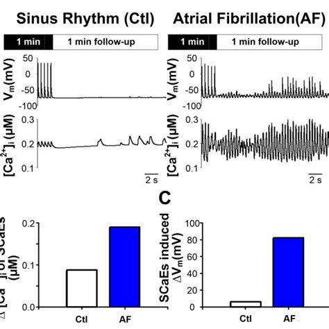 Subcellular Calcium Dynamics In Atrial Myocytes Under The Sinus Rhythm Download Scientific