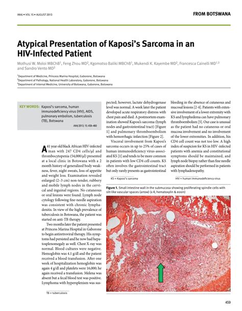 Pdf Atypical Presentation Of Kaposis Sarcoma In An Hiv Infected Patient