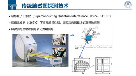 【磁源溯影】王群教授：新型无液氦脑磁图在癫痫诊断与脑功能区定位的创新应用 脑医汇