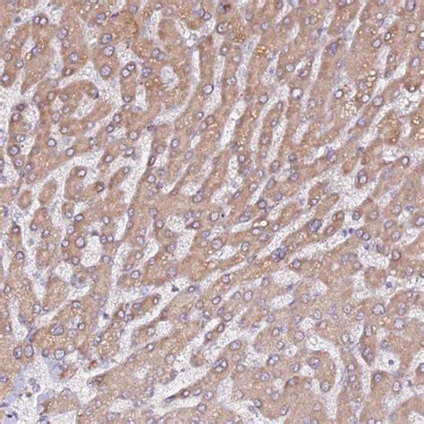 HSD17B7 Polyclonal Antibody Invitrogen 100 μL Unconjugated Antibodies