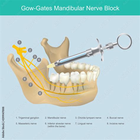 Mandibular Nerve Block In Pediatric