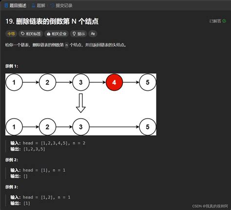 Leetcodehot100——链表篇leetcode Hot100题目 Java 实现链表 Csdn博客