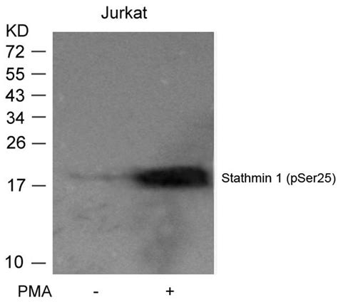 Stathmin1phospho Ser25 Antibody Sab Signalway Antibody