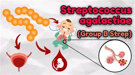 Streptococcus Agalactiae A Comprehensive Guide Streptococcus Agalactiae Physiology Sialic Acid