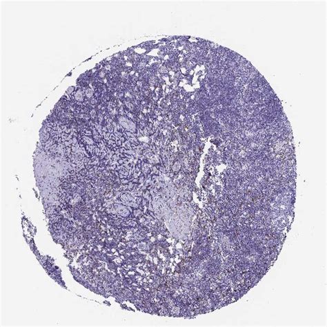 Tissue Expression Of Cd163 Staining In Tonsil The Human Protein Atlas