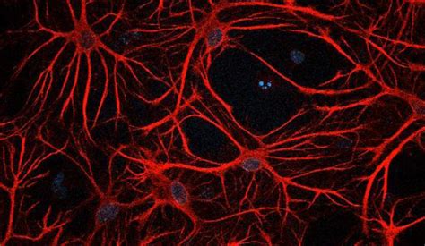 Astrocytes Guardians Of The Brain Dpz