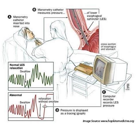 Lecture 1 Gi Exam 2 Flashcards Quizlet