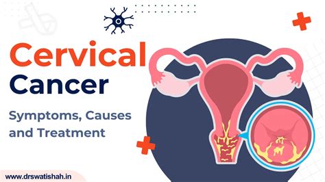 Cervical Cancer What Every Woman Should Know