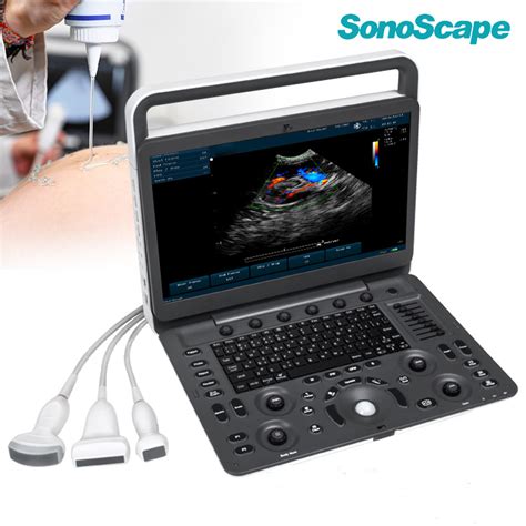 Sonoscape E1 Exp Color Doppler Sonoscape Medical Ultrasound Instruments