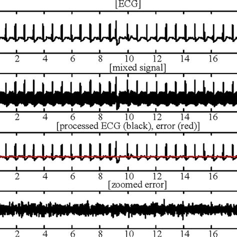 Pdf Power Line Interference Removal From High Sampled Ecg Signals Using Modified Version Of