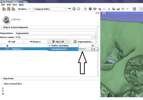 smoothing factor community 3d slicer community