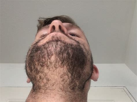 Patchy Beard Success Stories Before And After Photos Page Beard Board