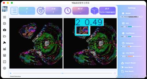基于yolov10深度学习的脑肿瘤检测系统【yolo脑肿瘤检测数据集ui界面模型摄像头实时检测】想做一个yolov医疗相关的模型算法 有没有相关公开的数据集 Csdn博客