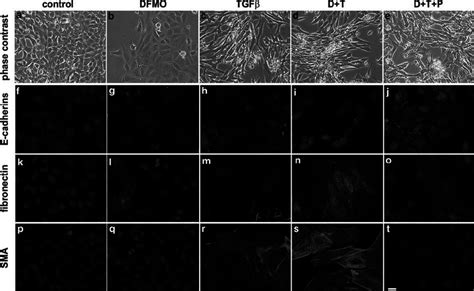 Phase Contrast A E Or Immunofluorescence F V Of Mdck Cells
