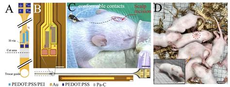 New Technologies Make Neural Implants Biocompatible And More Durable