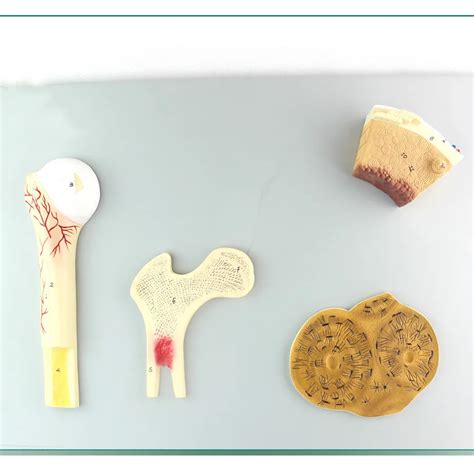 Humans Bone Structure Modelcancellous Bonecompact Bone And Femur Bone Haversian System Model