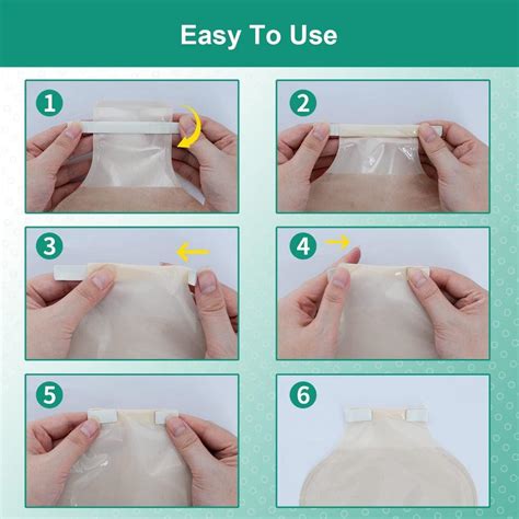 Steps For Replacing An Early Stage Two Piece Ostomy Pouch Konweda