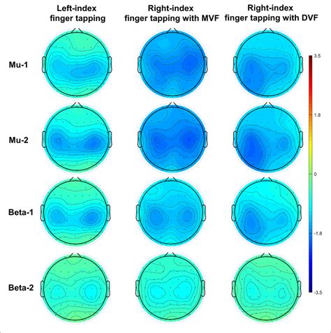 Figure 3 From The Effects Of Priming Intermittent Theta Burst