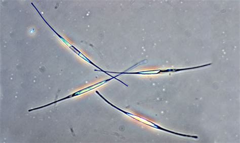 Nitzschia Longissima Marine Biodiversity Portal Of Bangladesh